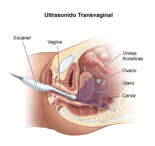 Pelvic Ultrasound - Stanford Medicine Children's Health